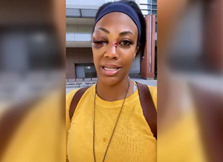Olympic Medalist Describes Attack By Stranger In Downtown LA - The ...