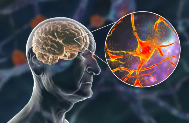 Combat Memory Loss With These Brain-Boosting Foods - The Seattle Medium